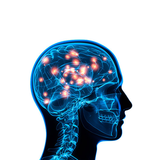 Types of Vertigo | Vertigoheel®